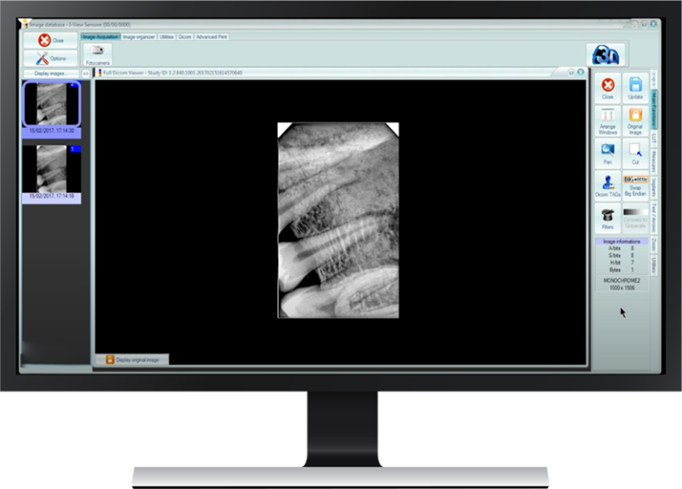 Software - Trident Dental - Dental digital imaging systems