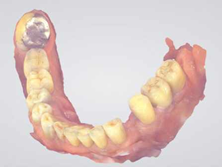 Triscan - Trident Dental - Dental digital imaging systems